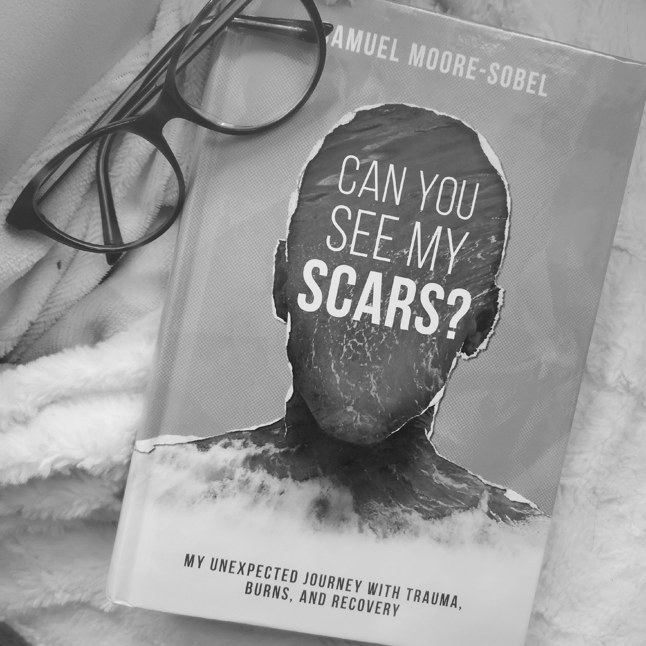 Can You See My Scars by Samuel Moore-Sobel – CravenWild